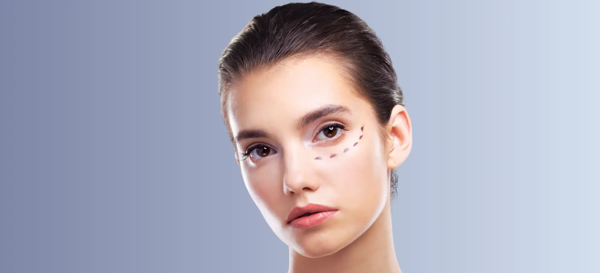 Under Eye Wrinkles | Dermamina